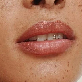 Piercing no dente: o que você precisa saber antes de colocar - Blog ...
